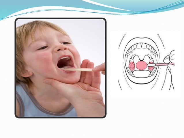 Pelatihan swab nasofaring dan orofaring yang benar | PPT