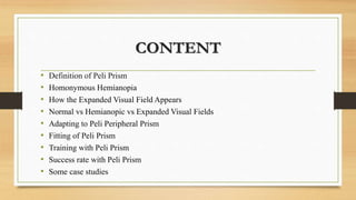 Peli’s Field Expansion Prisms.pptx
