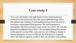 Peli’s Field Expansion Prisms.pptx