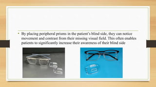Peli’s Field Expansion Prisms.pptx