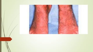 Pellagra vitamin deficiency and treatment.pptx
