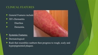 PELLAGRA.pptx .................. .. | PPTX