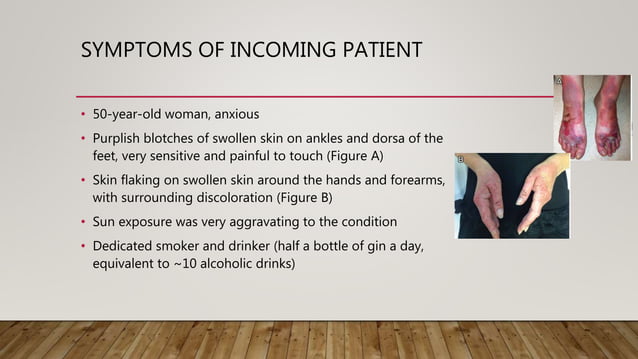 Pellagra Biochemistry Case Study | PPT