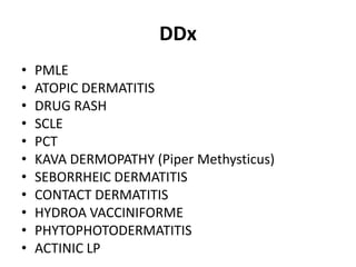 Pellagra by aseem | PPTX