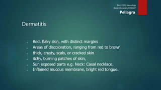 Pellagra ppt show 20200428 db | PPSX
