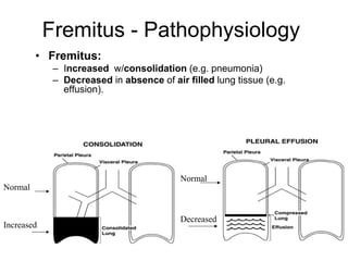 Pe lungexam | PDF | Lung and Respiratory Health | Diseases and Conditions