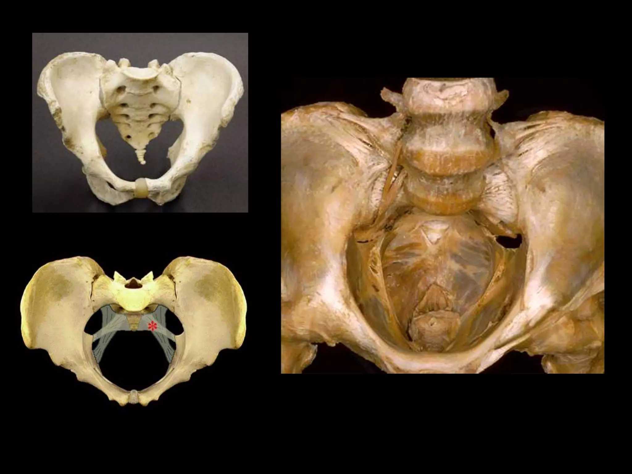 Pelve perineo| Medicine| Medicina | PPT