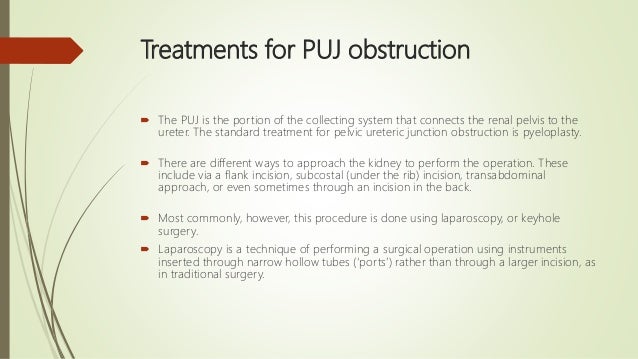 Pelvi Ureteric Junction Dr Ali Thwaini