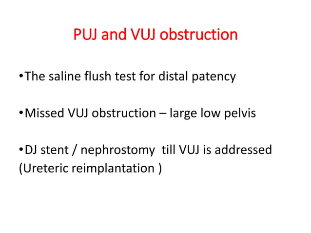 Pelvi-ureteric junction obstruction | PPTX | Digestive Disorders ...