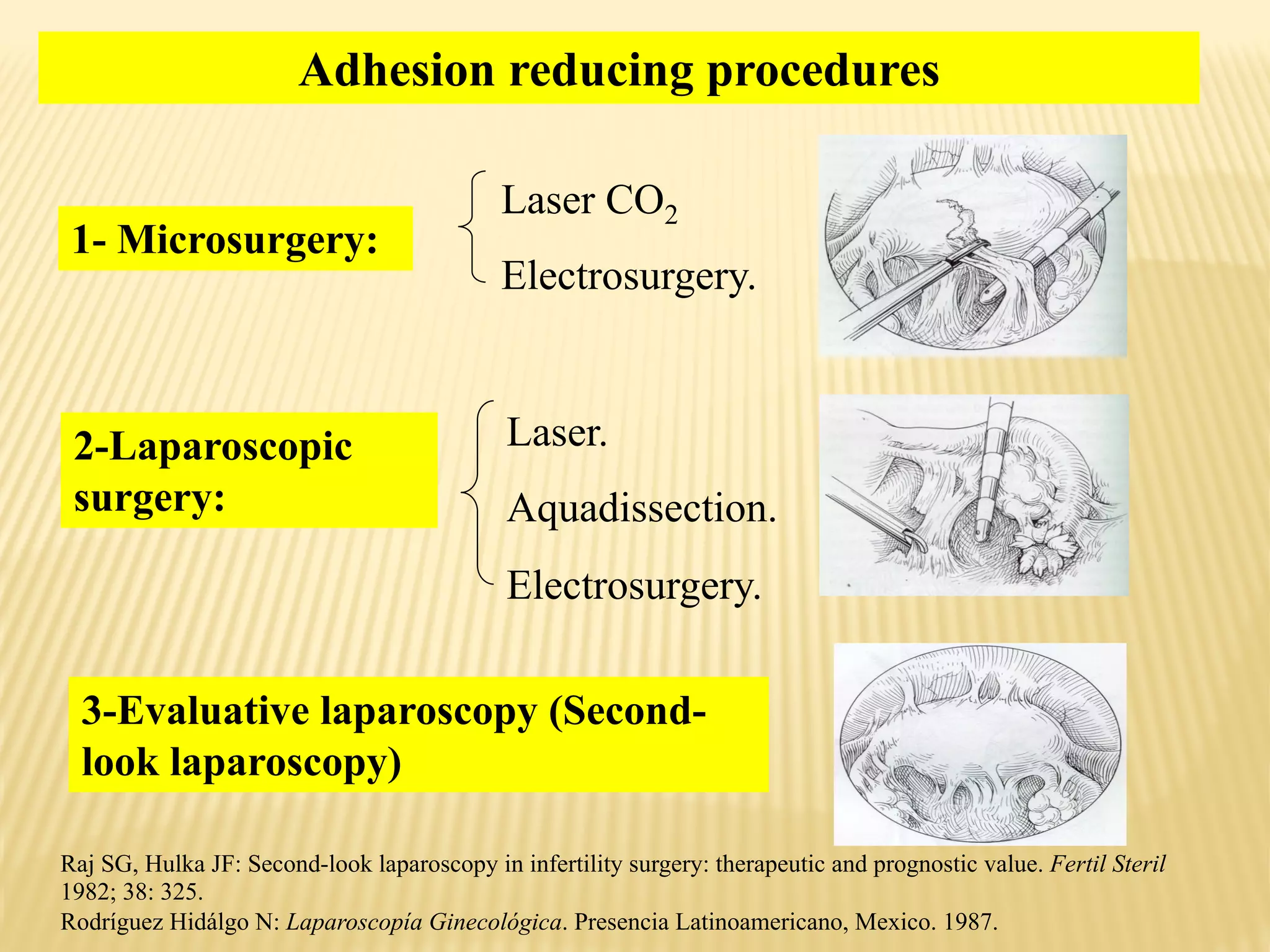 PELVIC ADHESIONS & ADHESIOLYSIS-OSAMA WARDA | PDF | Infertility ...