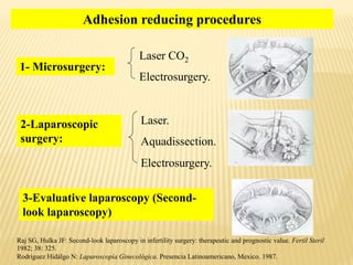 PELVIC ADHESIONS & ADHESIOLYSIS-OSAMA WARDA | PDF | Infertility ...