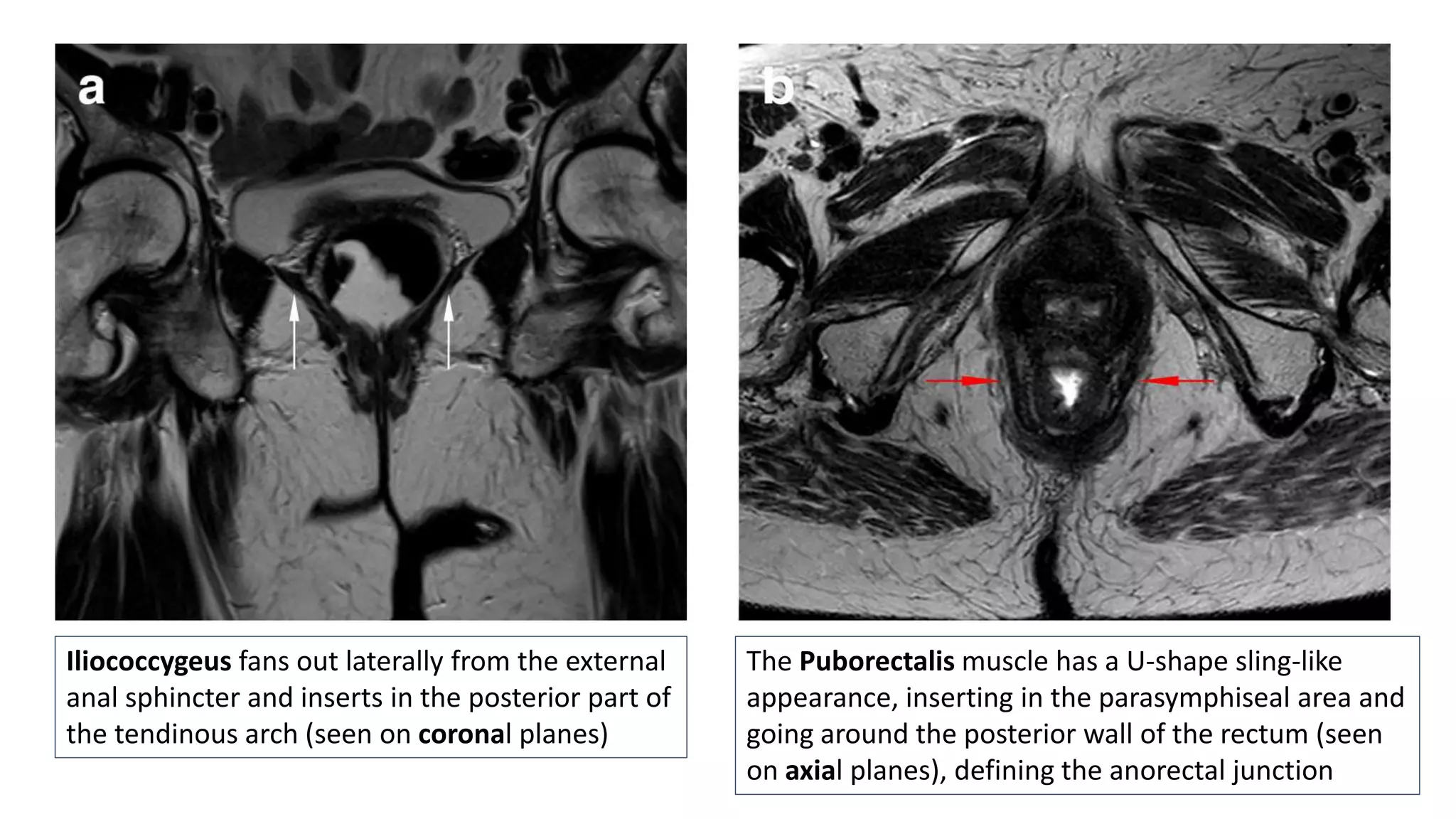 Pelvic anatomy | PPTX