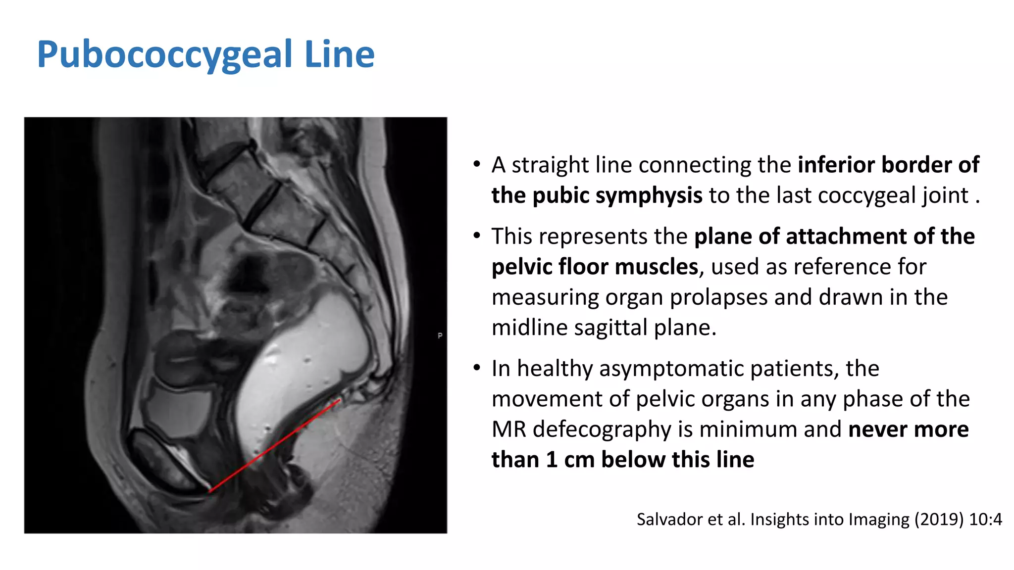 Pelvic anatomy | PPTX