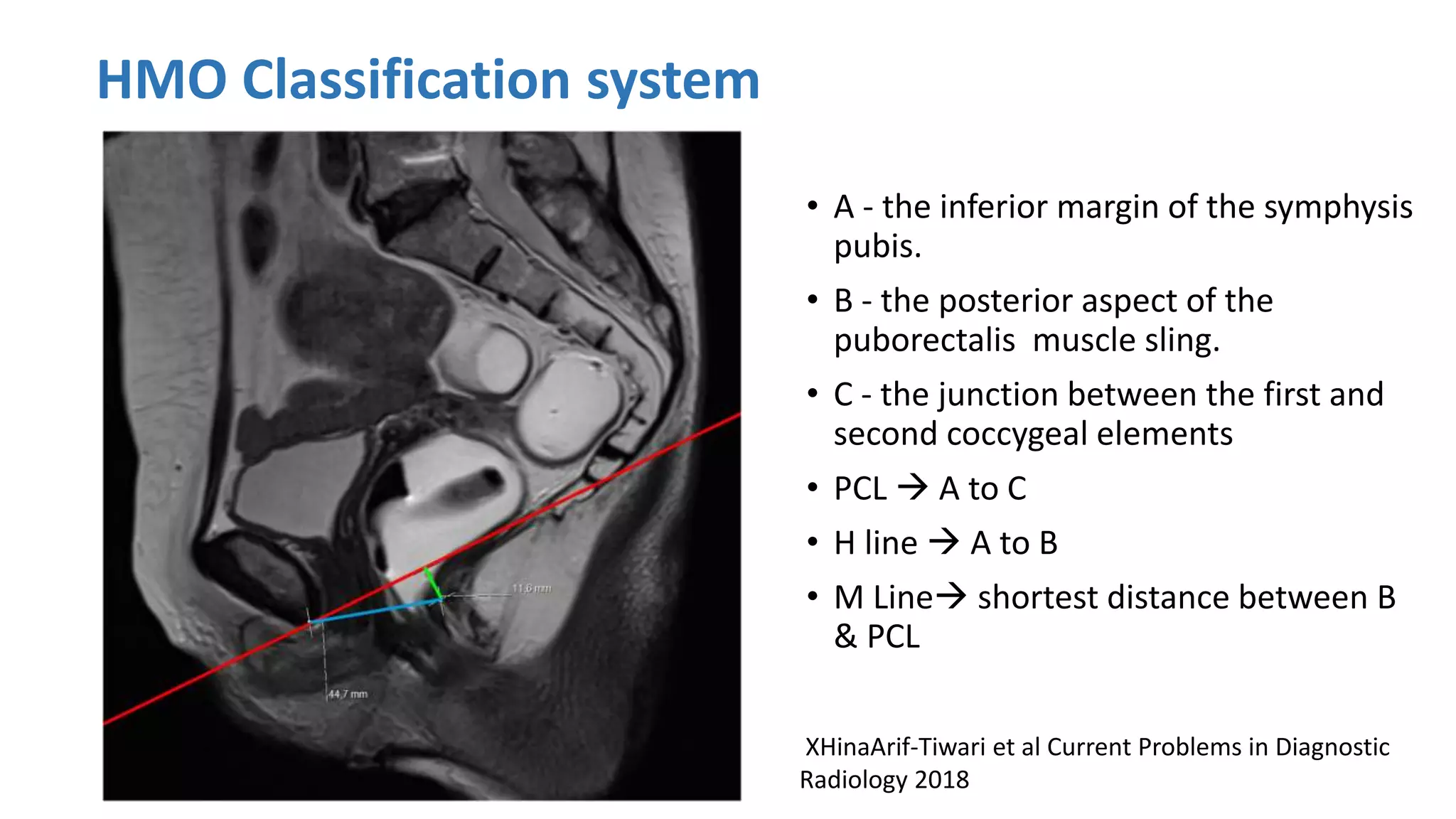 Pelvic anatomy | PPTX