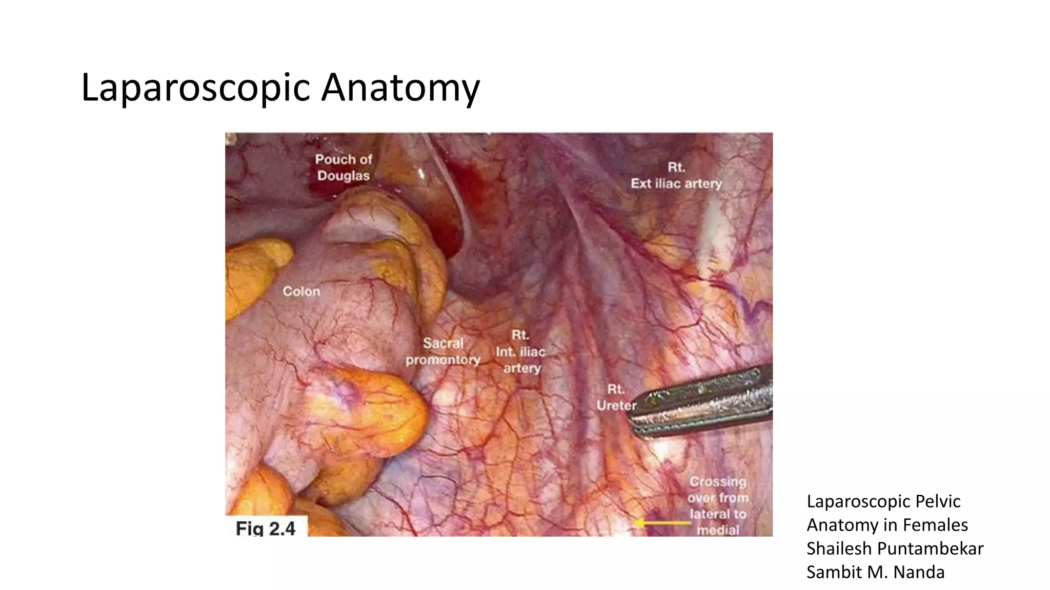 Pelvic anatomy | PPTX
