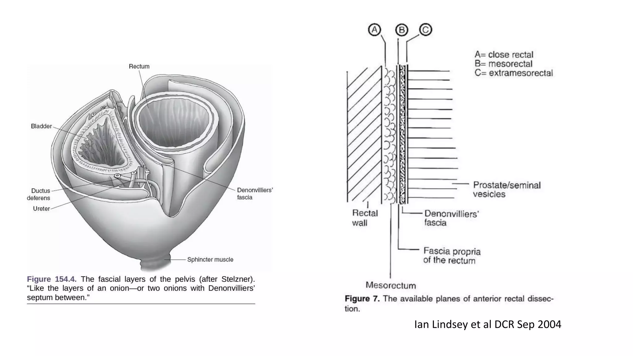 Pelvic anatomy | PPTX