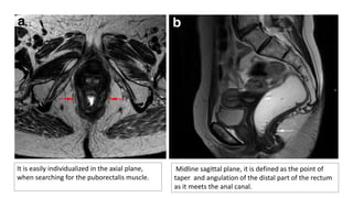 Pelvic anatomy | PPTX