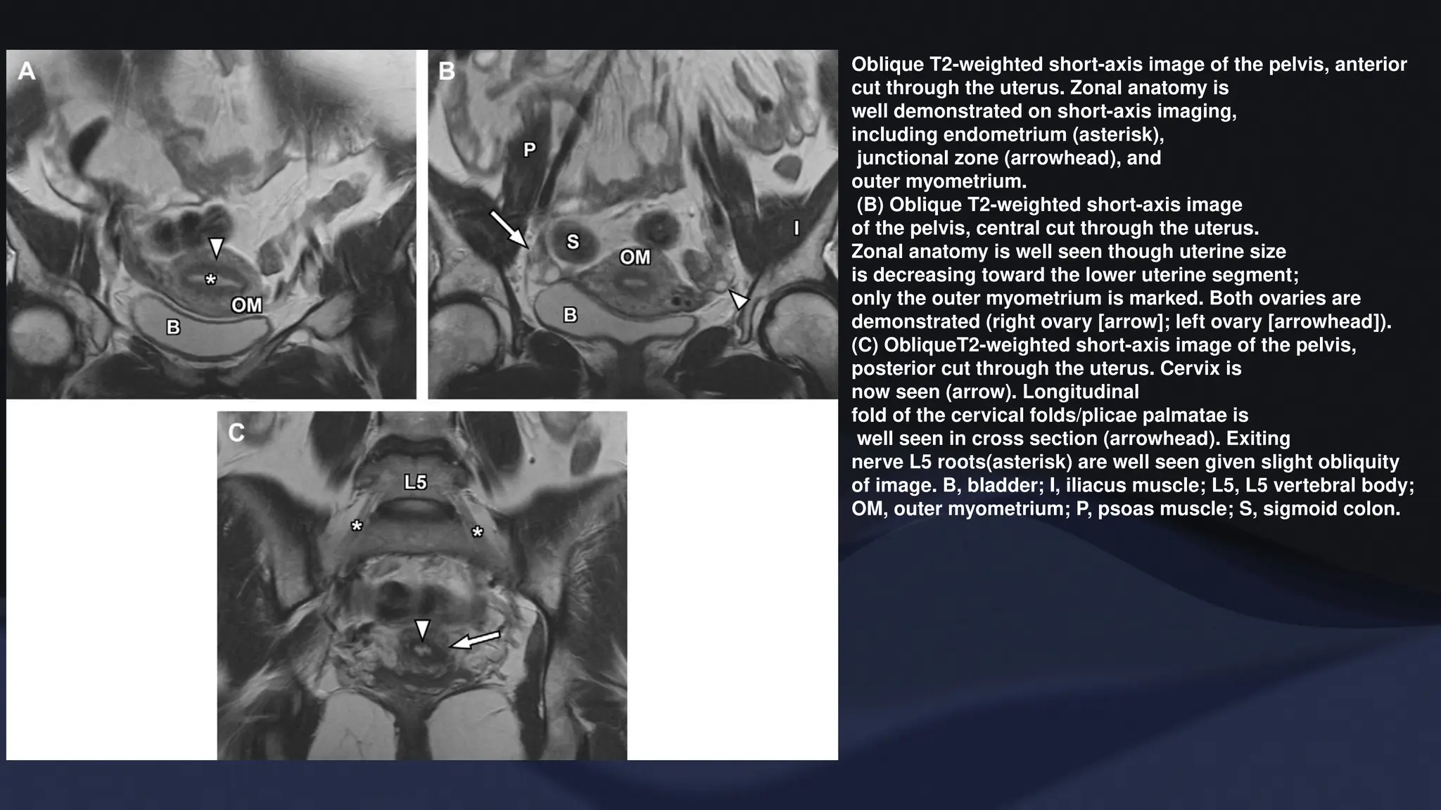 Pelvic anatomy MRI OF MALE AND FEMALE PELVIS.pptx
