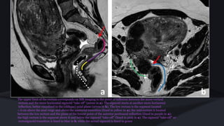 Pelvic anatomy MRI OF MALE AND FEMALE PELVIS.pptx