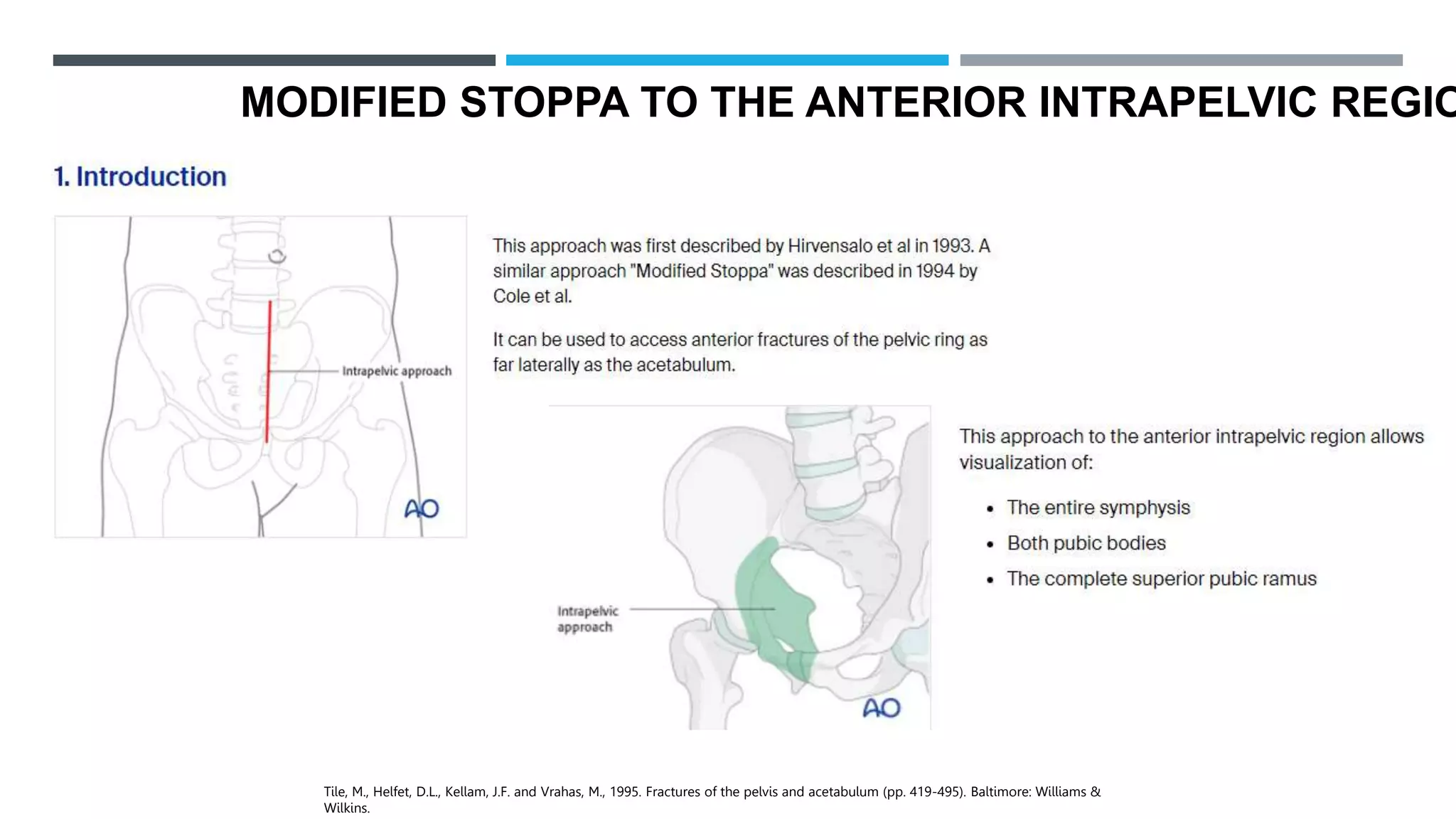 pelvic and hip approach.pptx