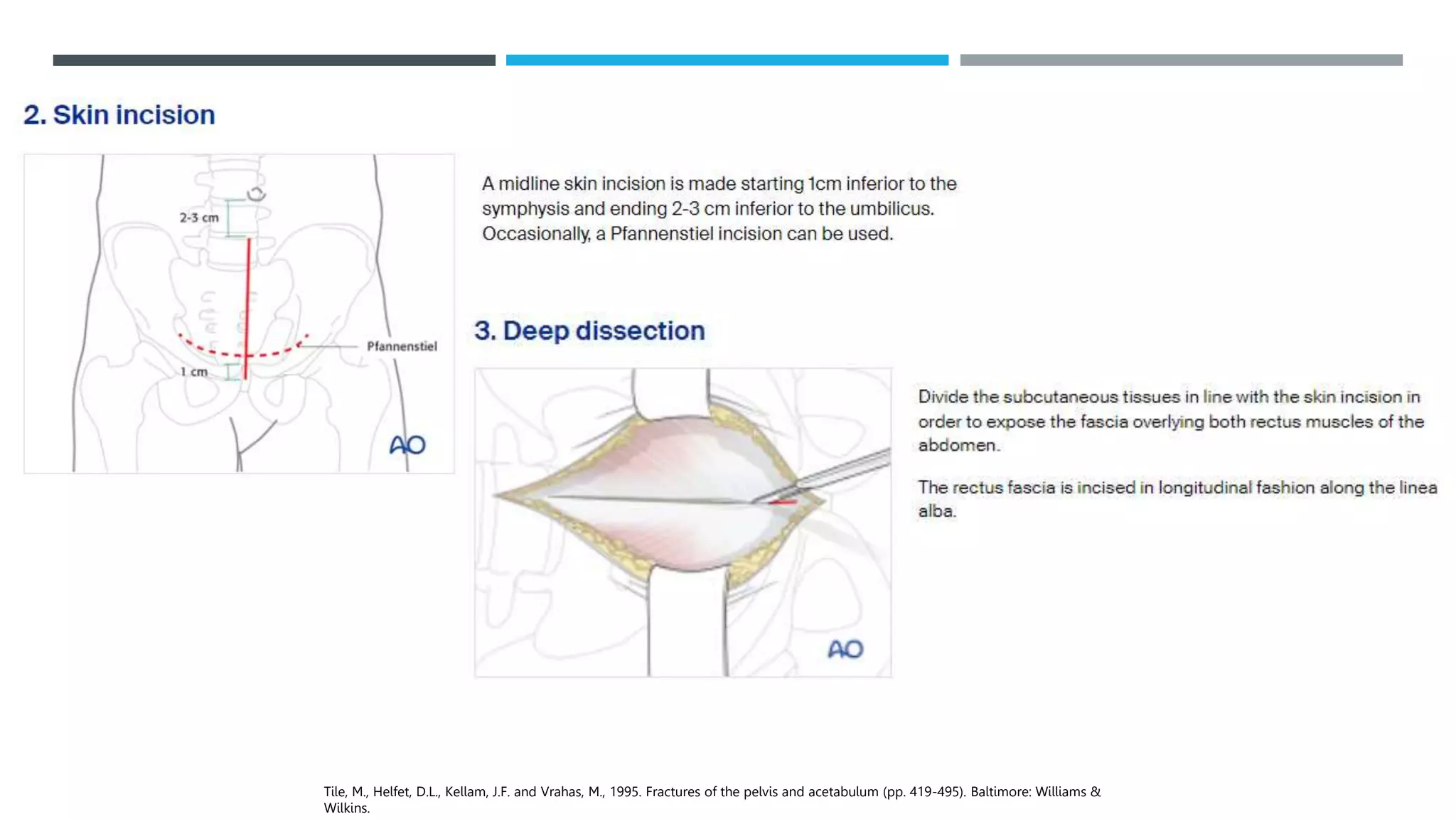 pelvic and hip approach.pptx