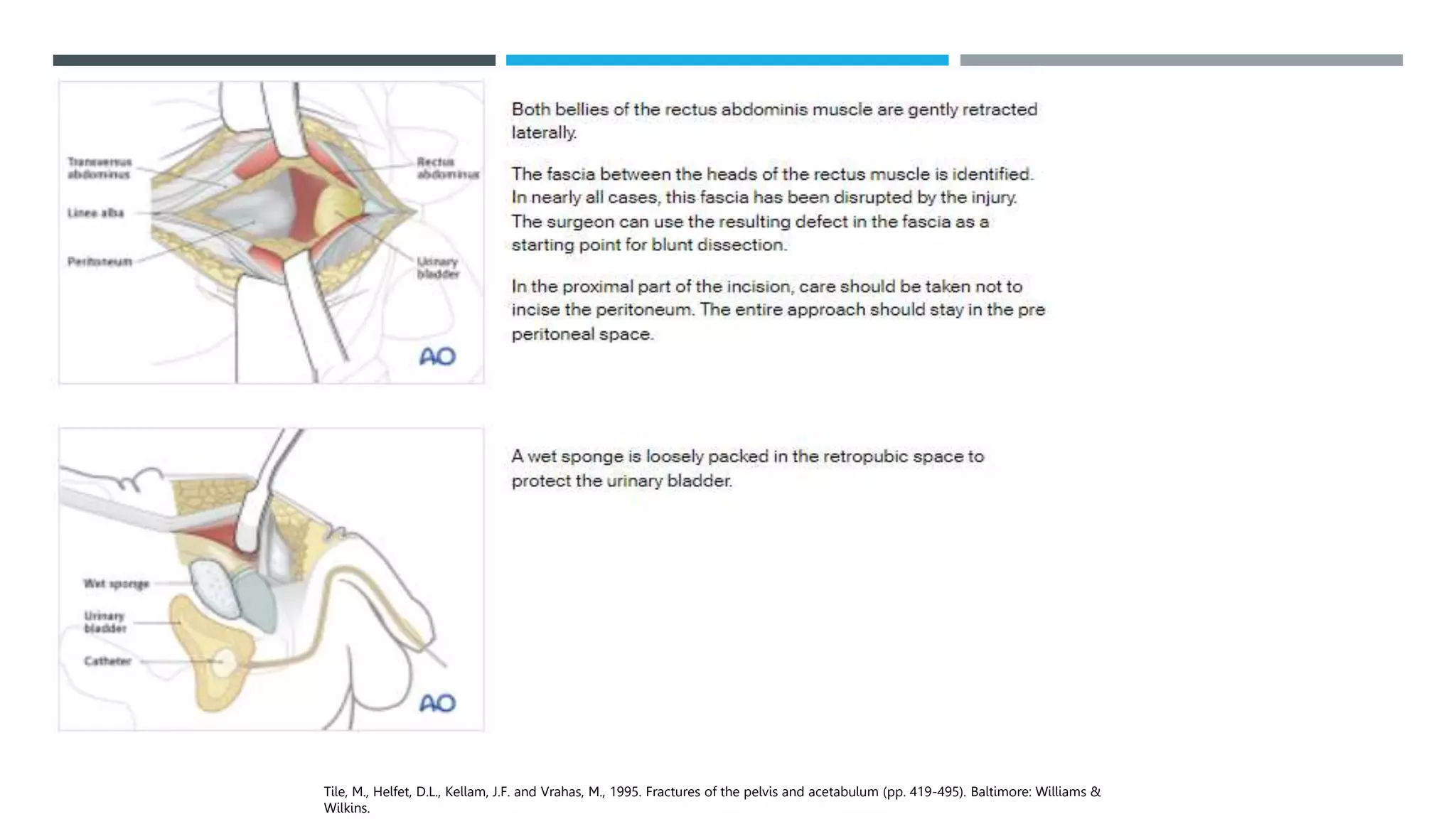 pelvic and hip approach.pptx