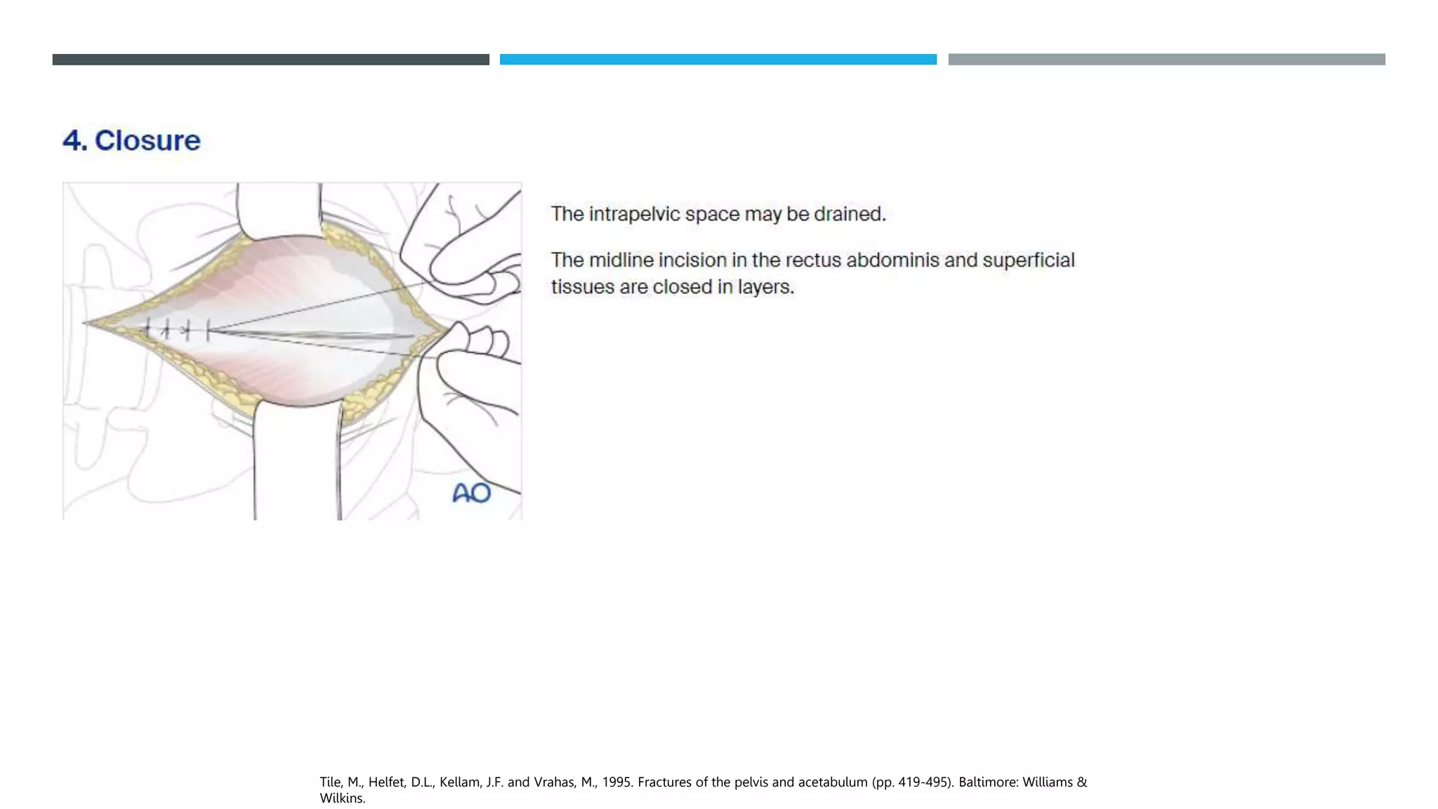 pelvic and hip approach.pptx