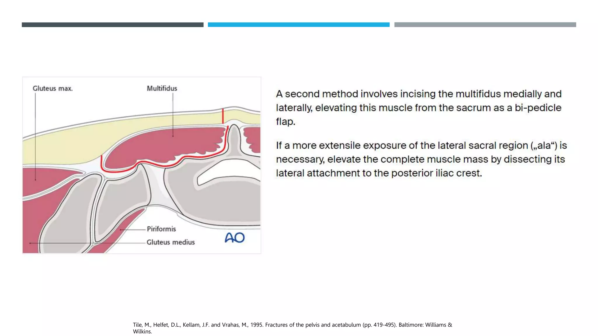 pelvic and hip approach.pptx