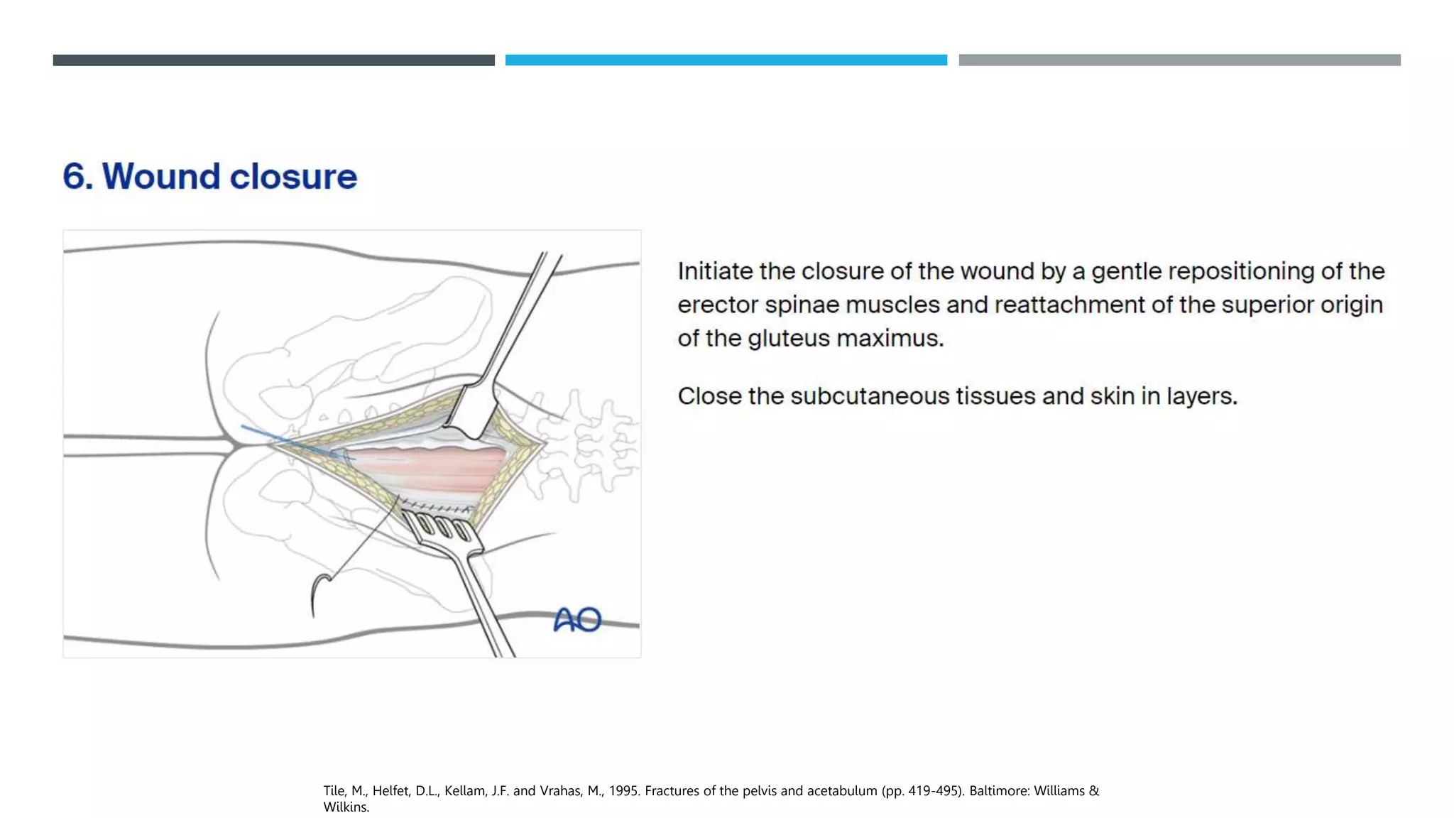 pelvic and hip approach.pptx