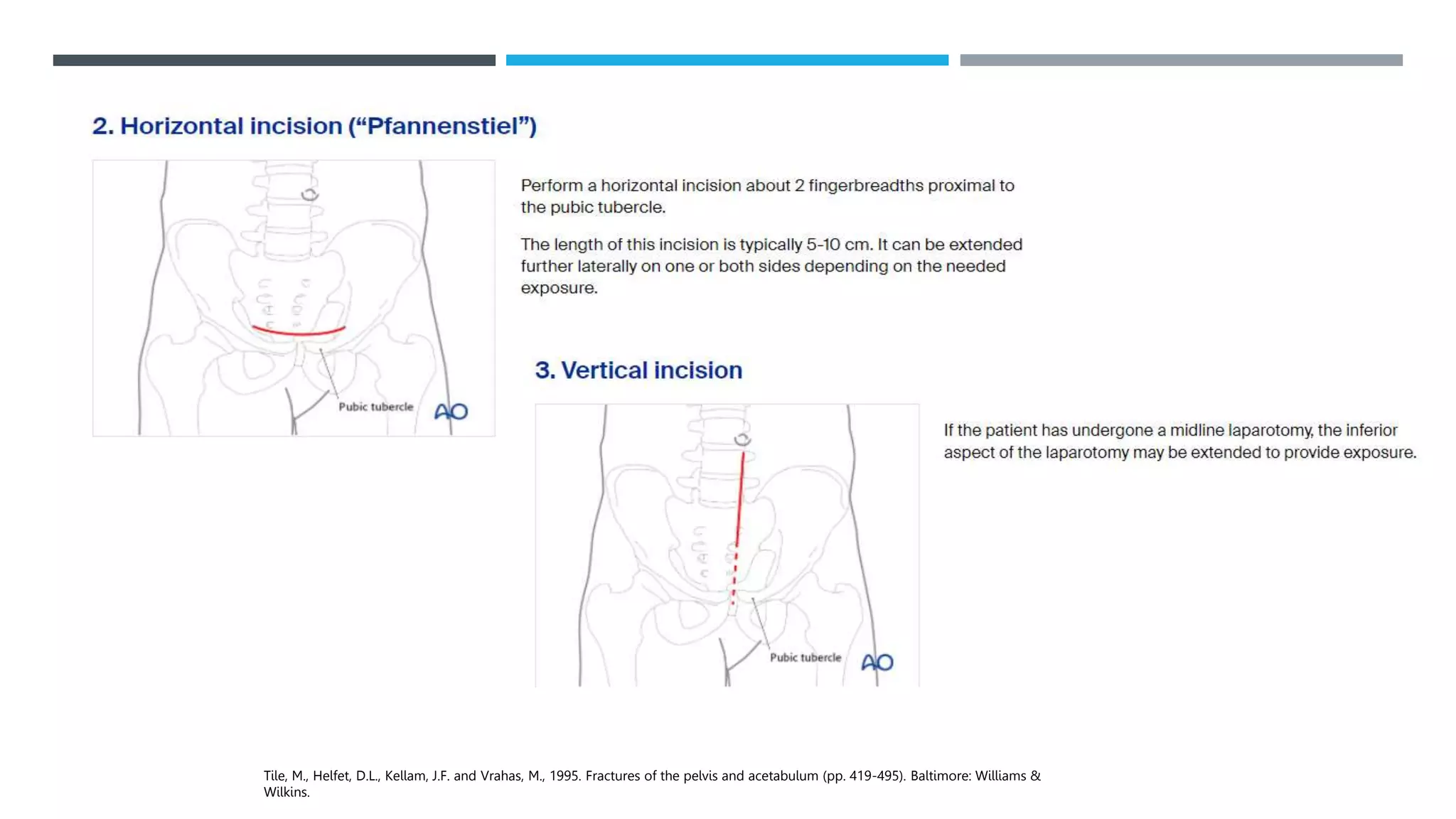 pelvic and hip approach.pptx