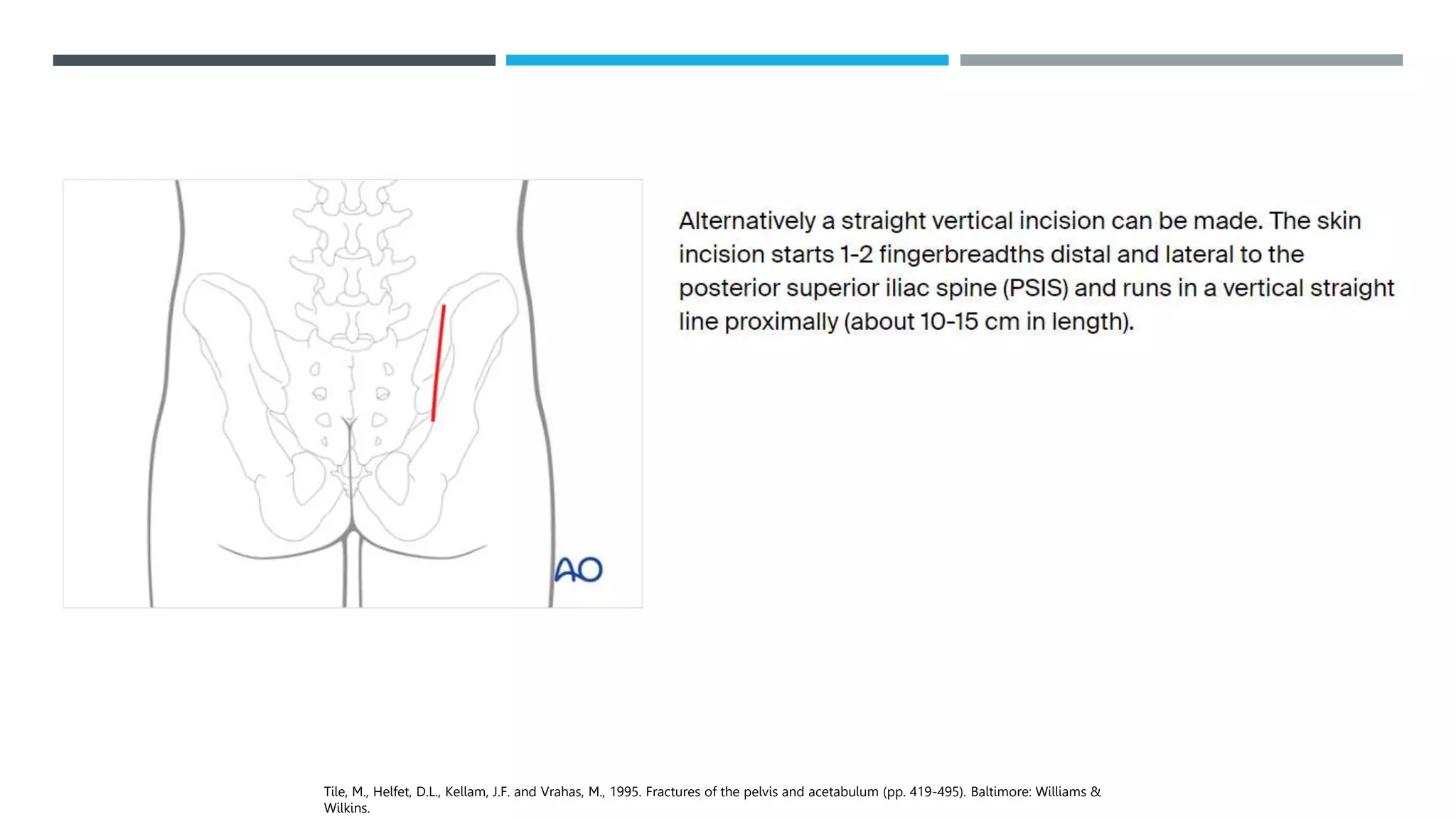 pelvic and hip approach.pptx
