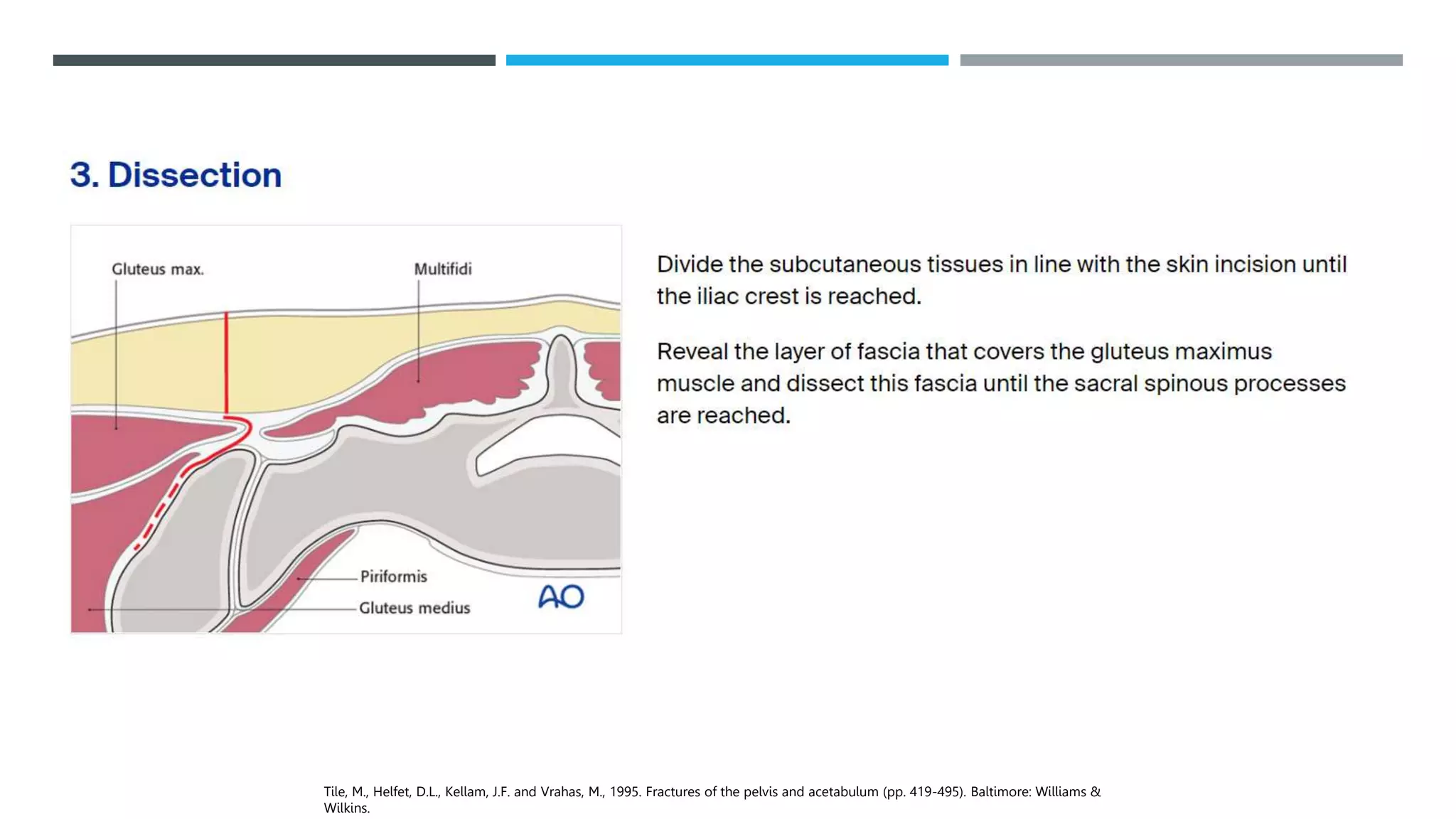 pelvic and hip approach.pptx