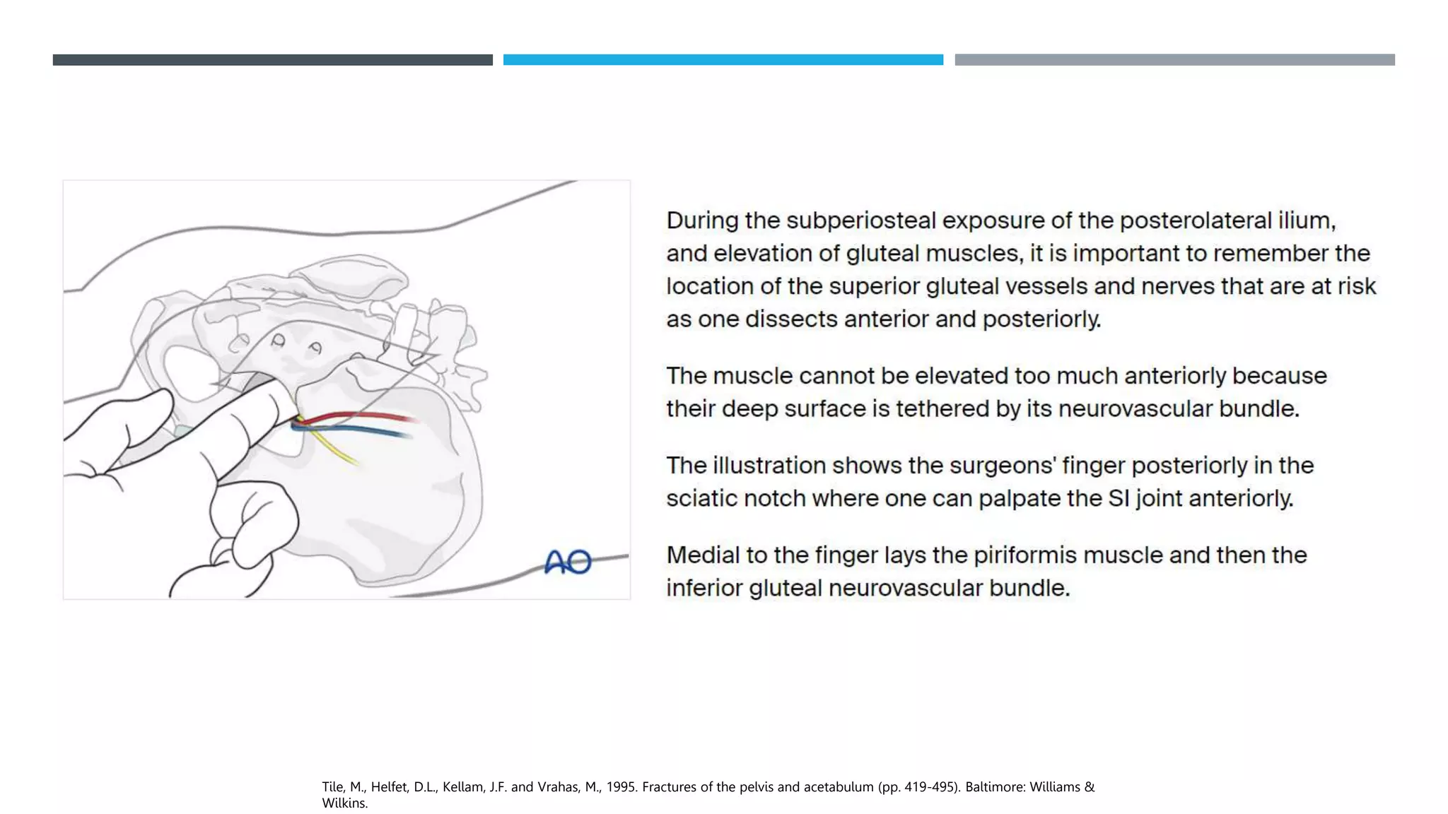 pelvic and hip approach.pptx