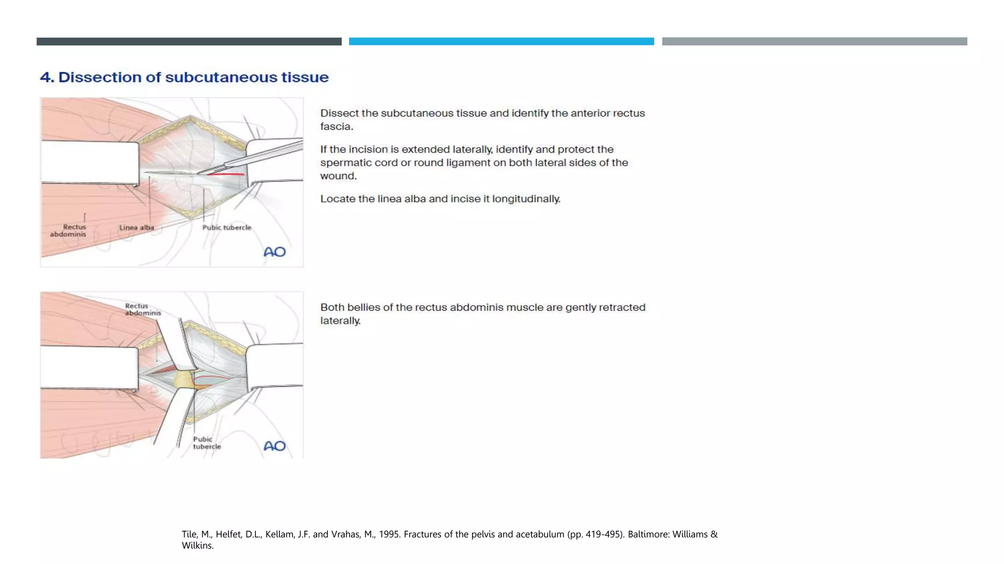 pelvic and hip approach.pptx