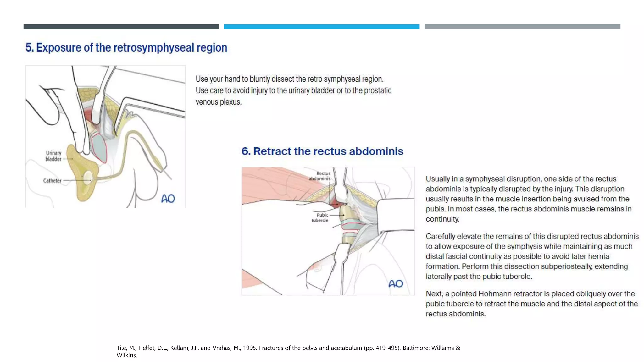 pelvic and hip approach.pptx