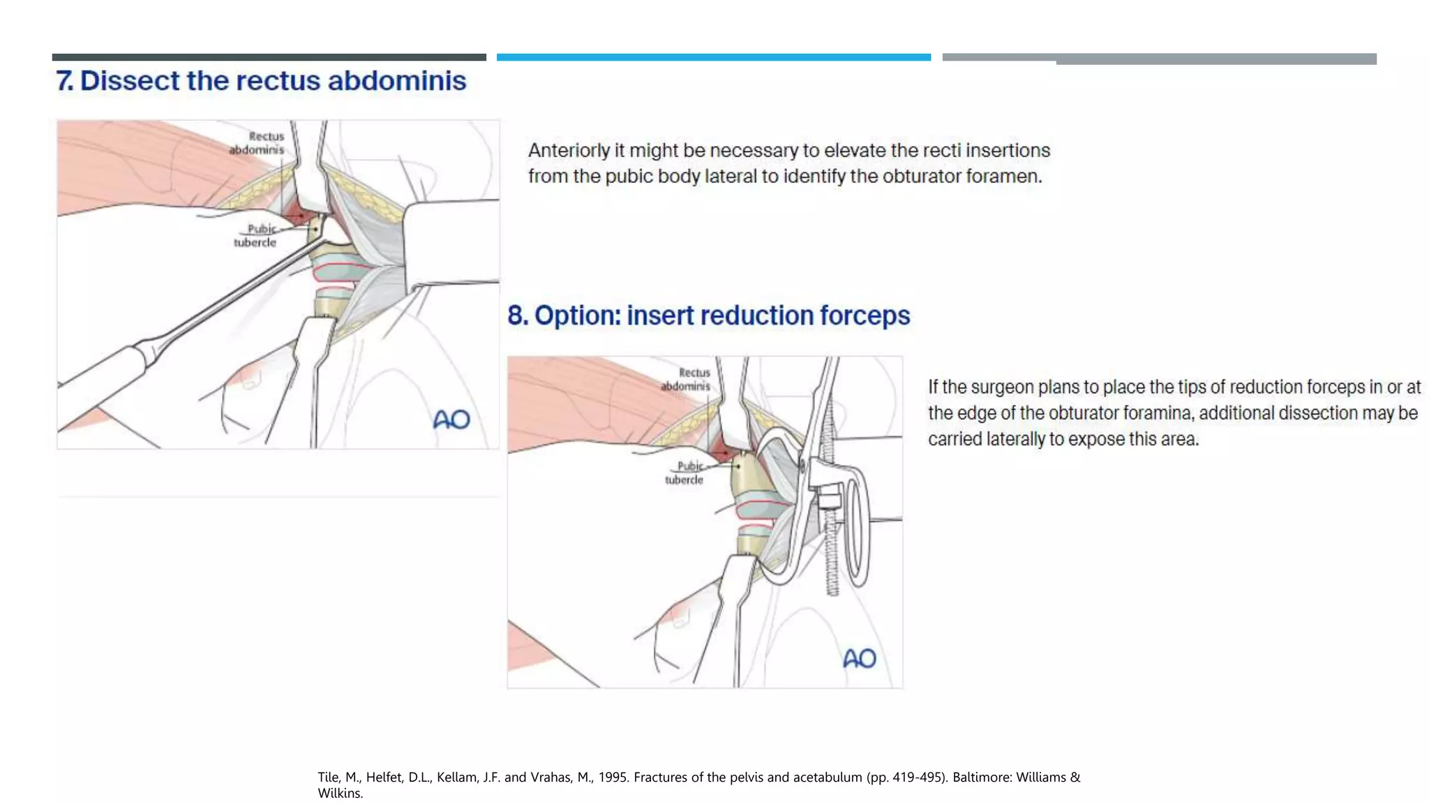 pelvic and hip approach.pptx