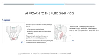 pelvic and hip approach.pptx