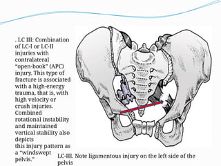 PELVIC # BKK - final.pptxPELVIC # BKKPELVIC # BKK | PPTX