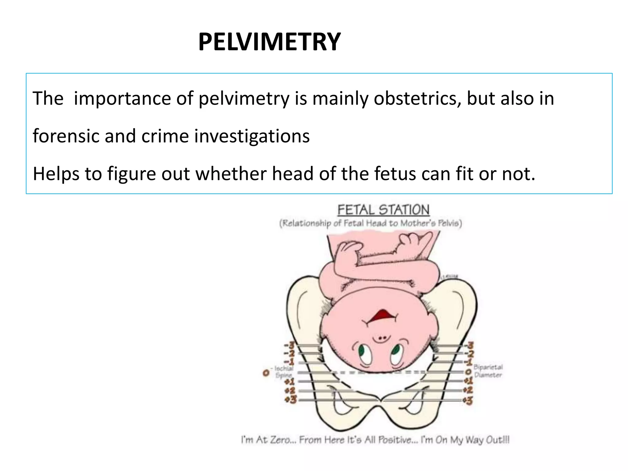 Pelvic bone.pptx