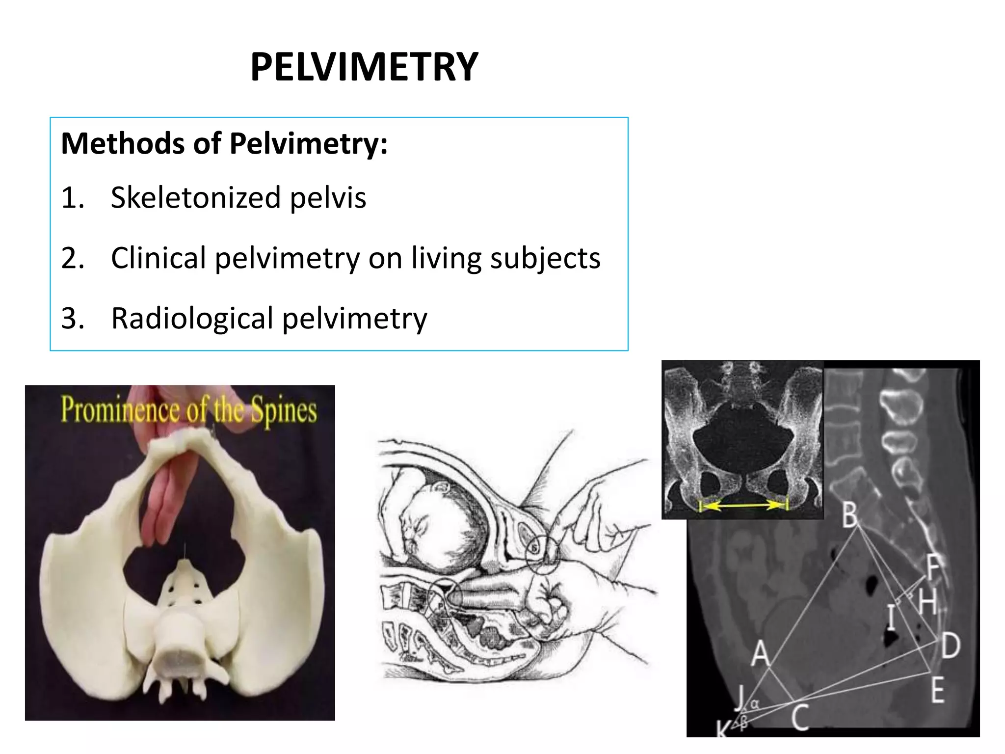 Pelvic bone.pptx