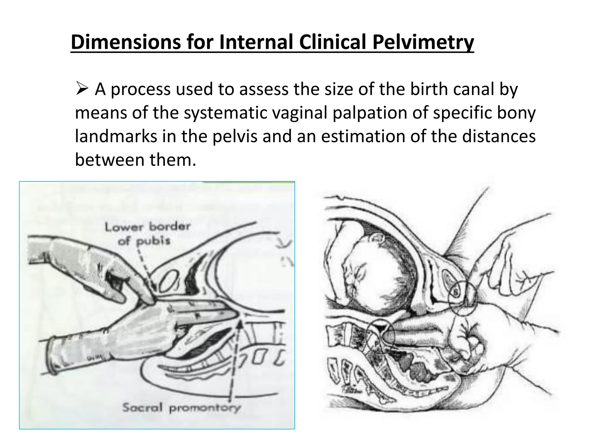 Pelvic bone.pptx