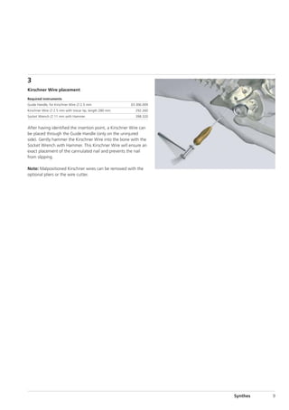 Pelvic c clamp | PDF