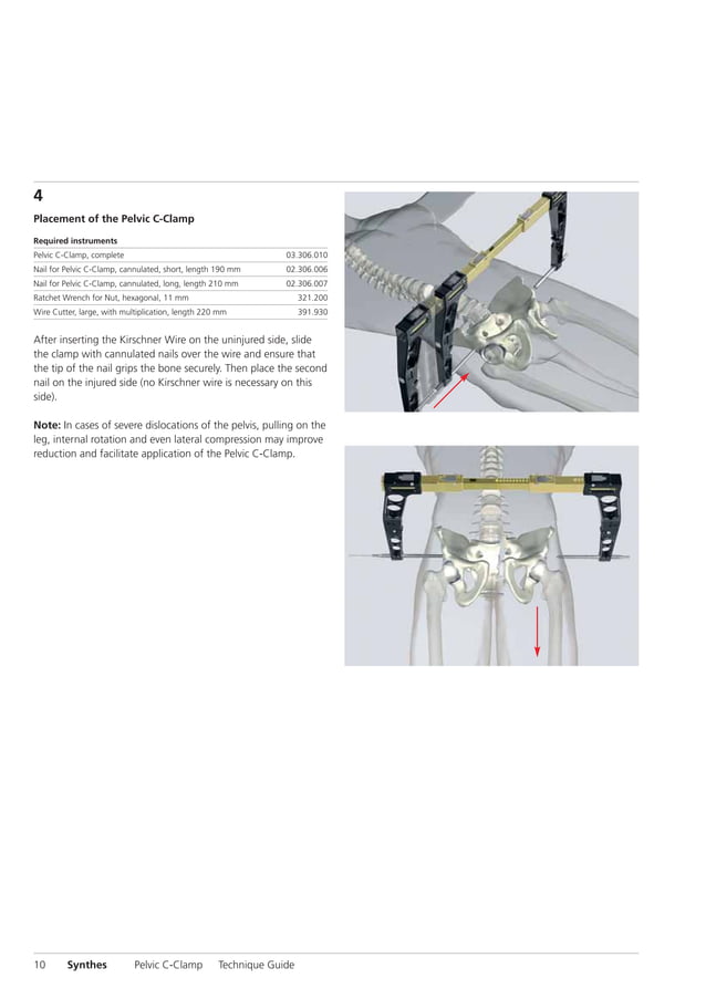 Pelvic c clamp | PDF | First Aid | Injuries
