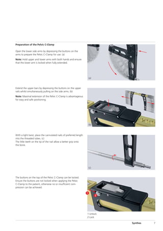 Pelvic c clamp | PDF