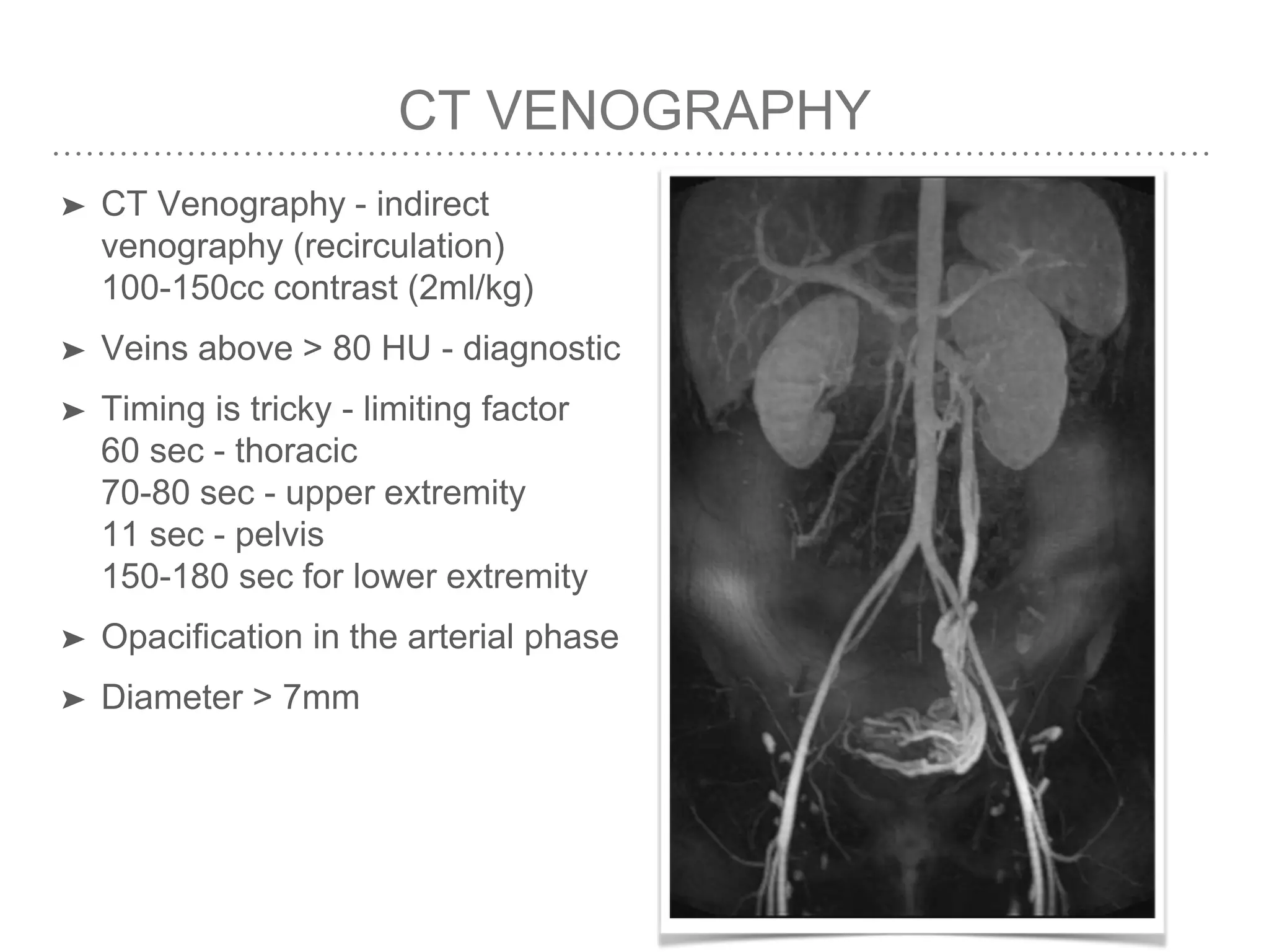 Pelvic Congestion Syndrome | PPTX