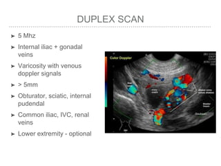 Pelvic Congestion Syndrome | PPTX