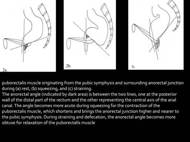 Pelvic Floor Ppt