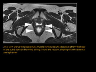 Pelvic floor | PPTX