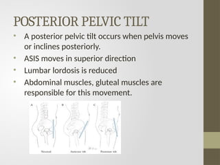 PELVIC FLOOR ASSESSMENT physiotherapy... | PPTX