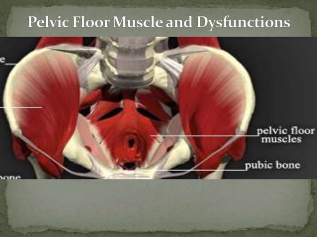 Pelvic floor muscle and dysfunctions | PPTX | Sexual Conditions ...